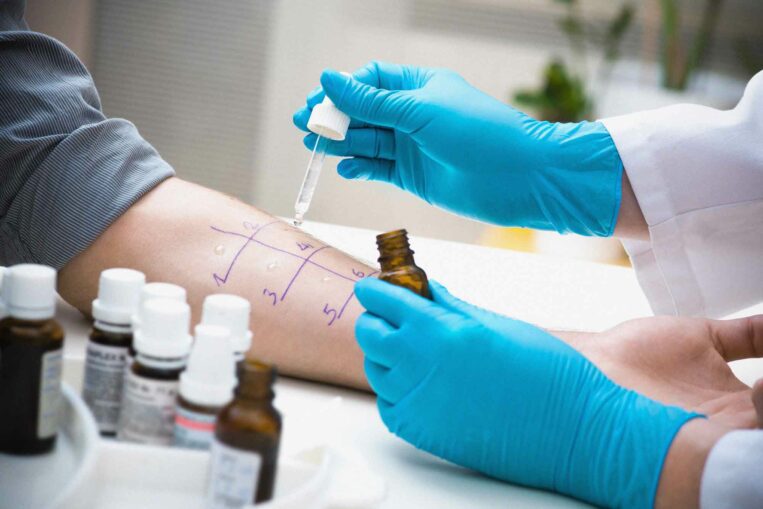What are Allergens? Understanding the Risks and Ensuring Safety ...